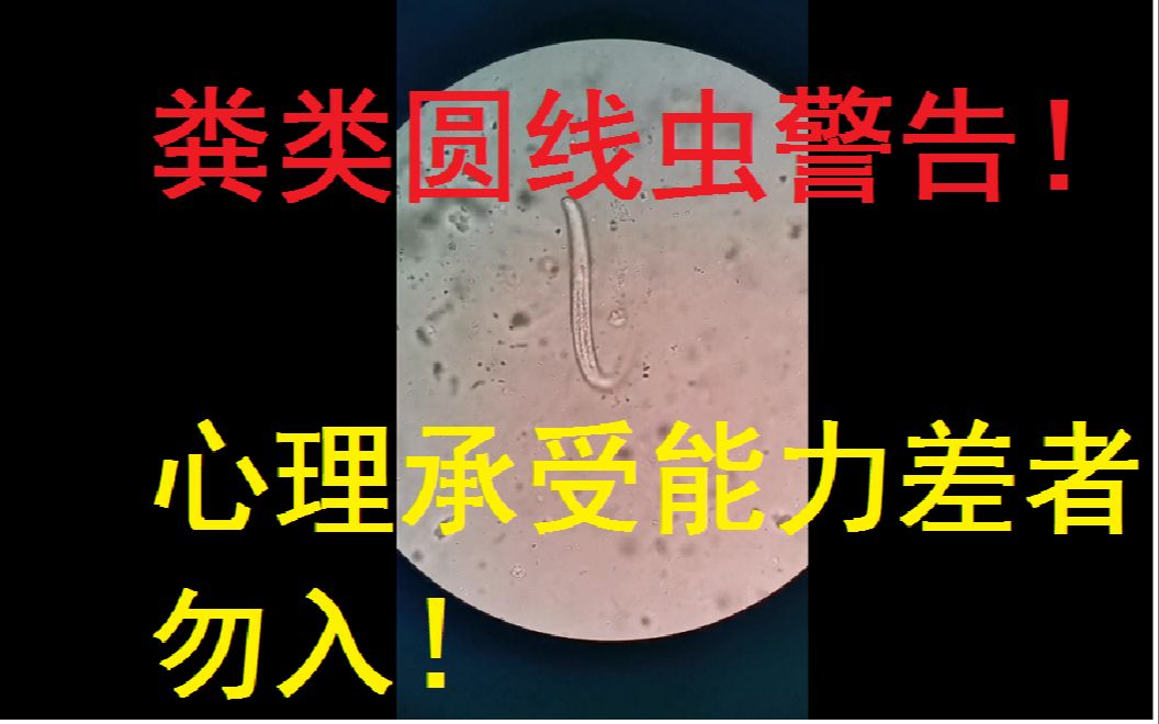 一条正在蹦哒的粪类圆线虫