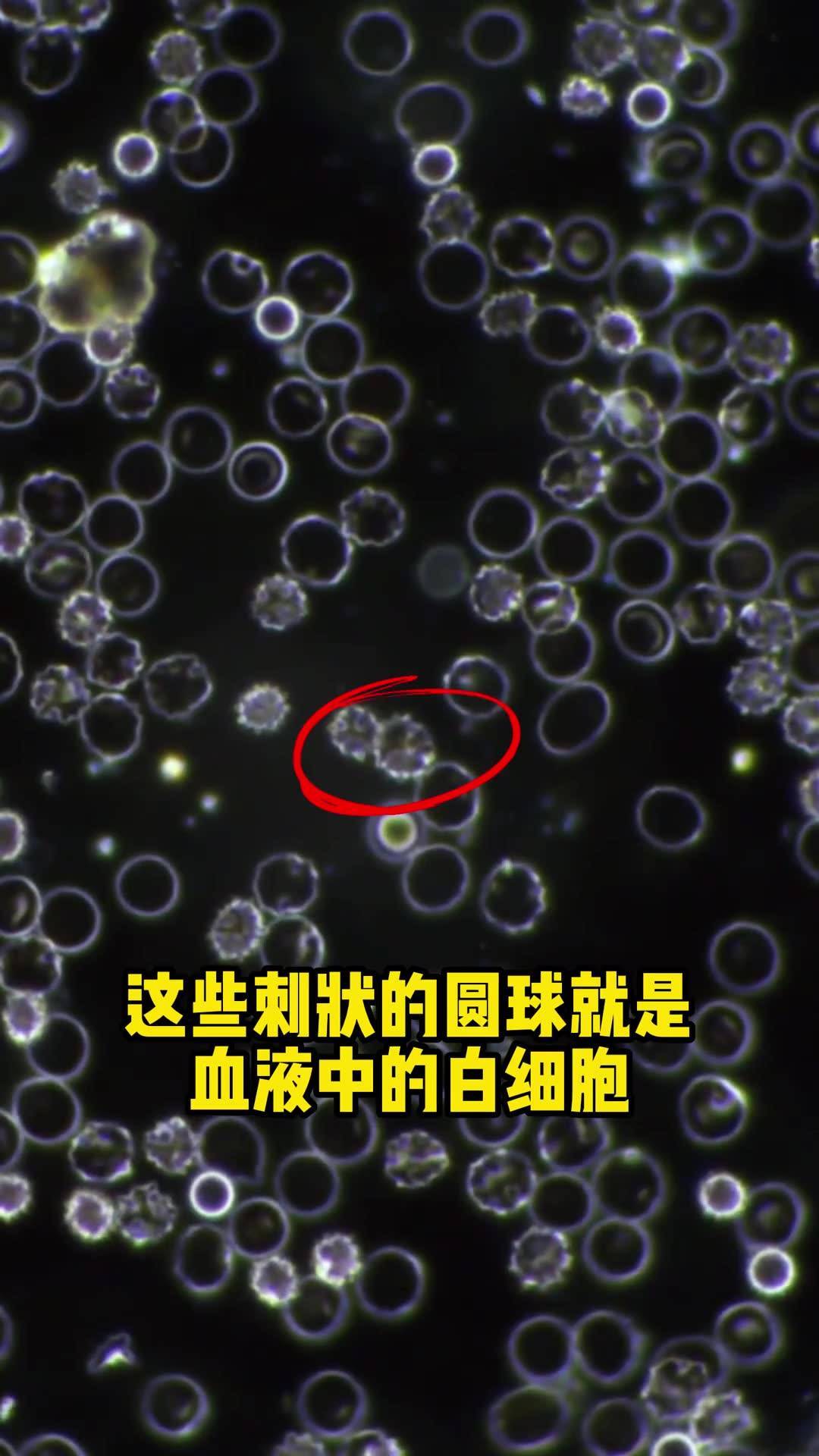 感冒后的血细胞发生的变化你见过么 ?