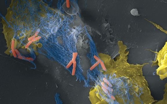 科研入门 | 中性粒细胞外陷阱(Neutrophil Extracellular Traps, NETs)