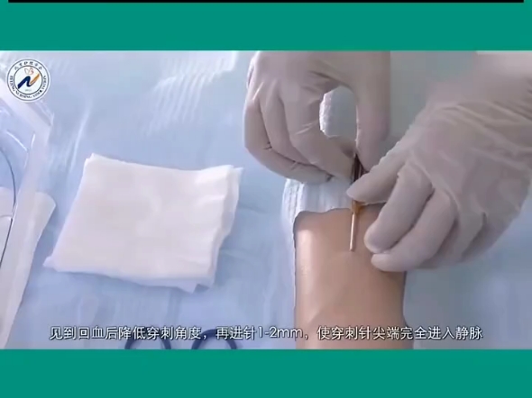 经外周筋脉置入的中心静脉导管(PICC)置管