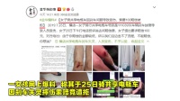 女孩骑共享电瓶车摔伤索赔100元遭拒 客服: 索赔金额过低走不了流程