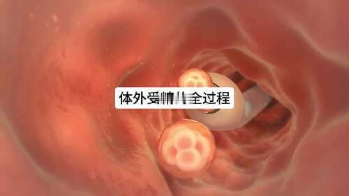 揭秘试管婴儿诞生全过程!从试管到生命的奇迹,每一步都震撼人心