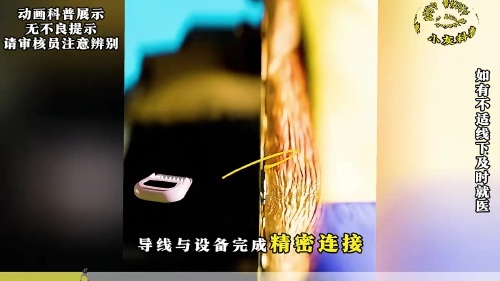 电脉冲止痛vs拔32颗牙!复仇反转太刺激
