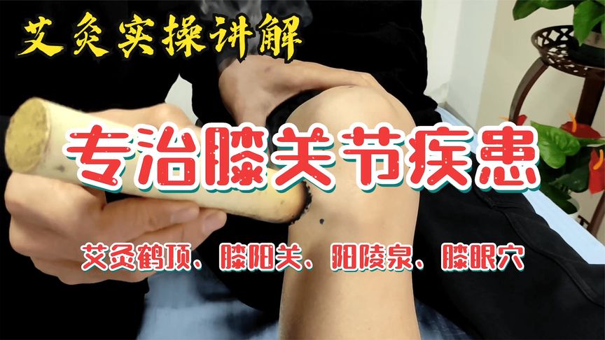 艾灸鹤顶、膝阳关、阳陵泉、膝眼,专治一切膝关节疾患