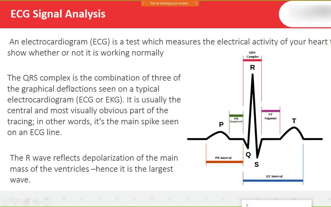 【cc字幕】在MATLAB中用机器学习实现ECG信号心律失常检测