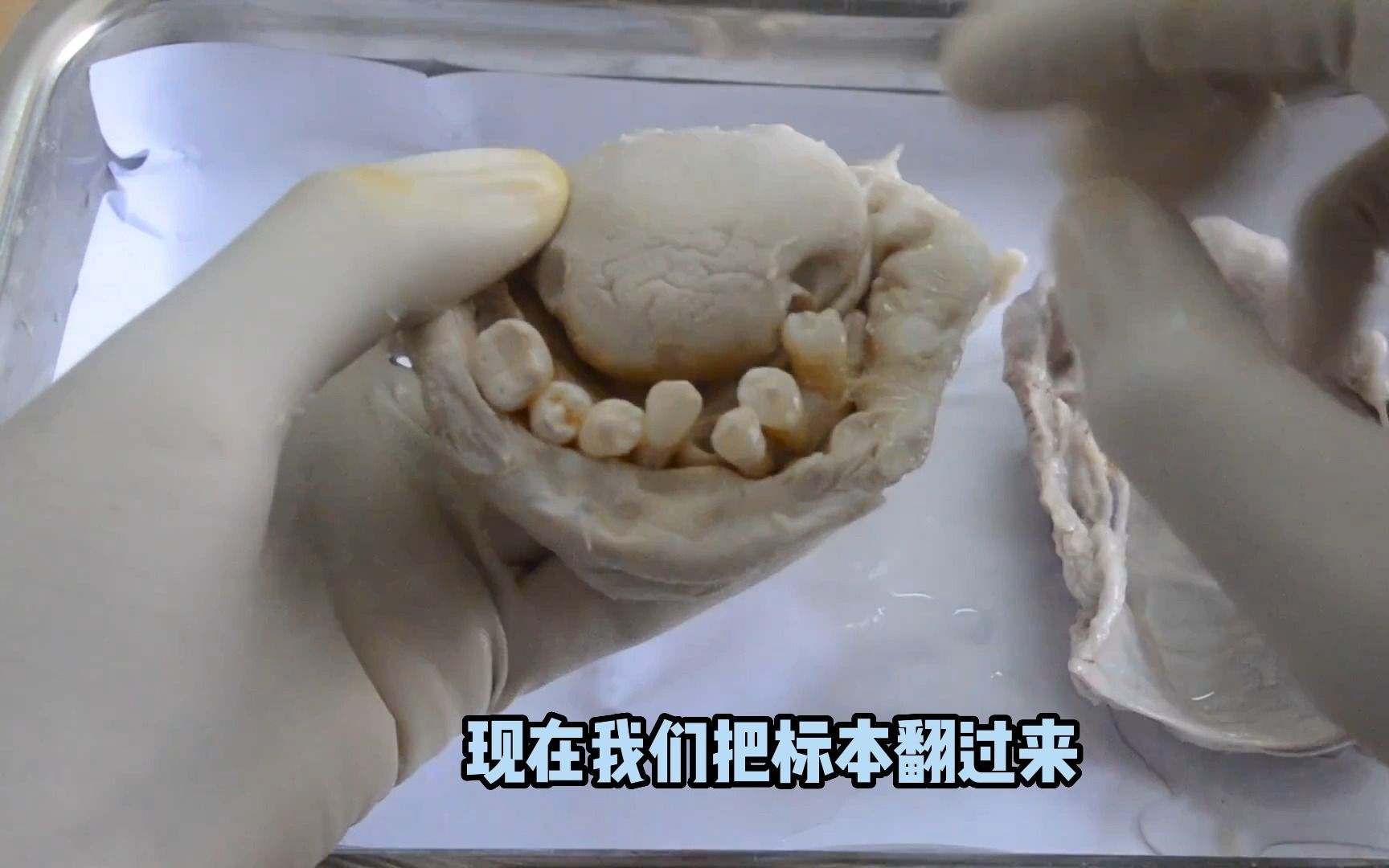 人体喉部标本---来看看会厌有什么作用吧