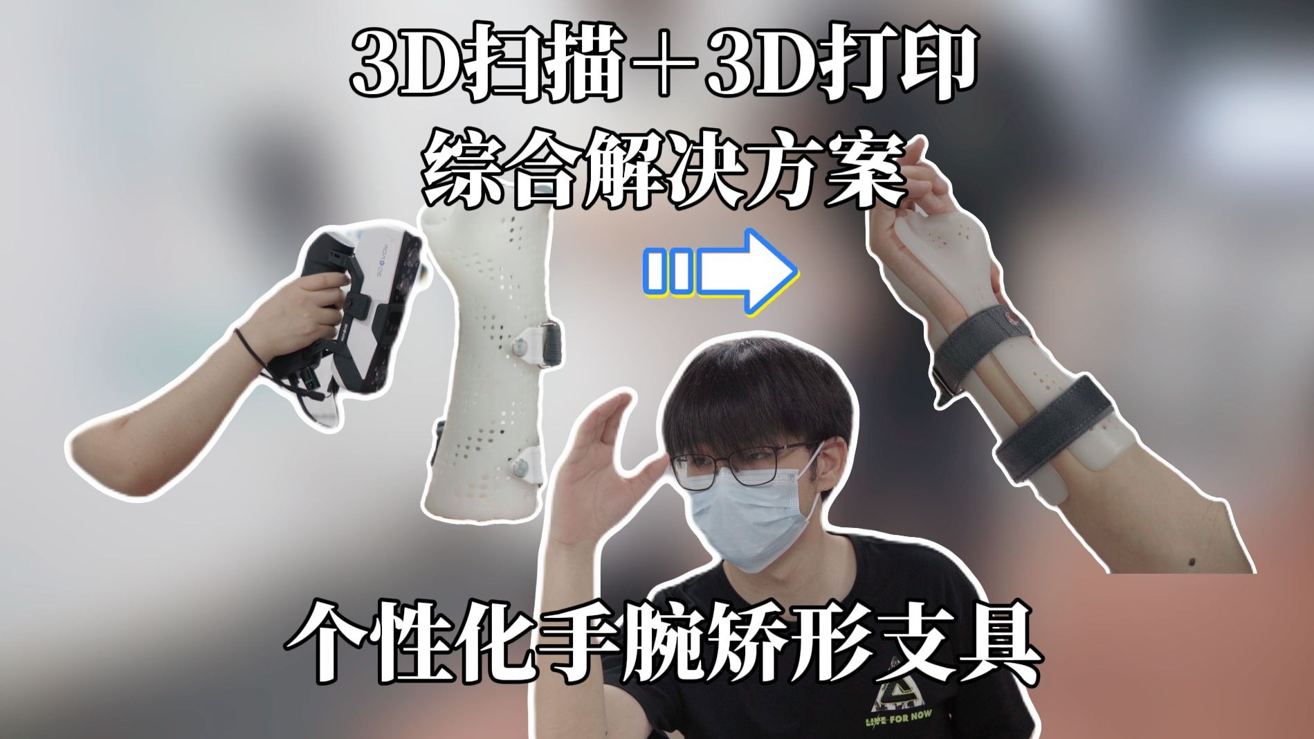 数字化矫形系列持续更新:手腕矫形3D个性化定制流程上线!