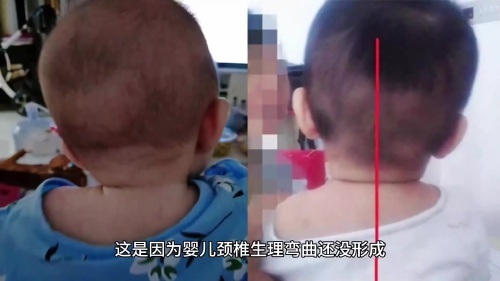 婴儿何时开始使用枕头,究竟会有哪些意想不到的影响?