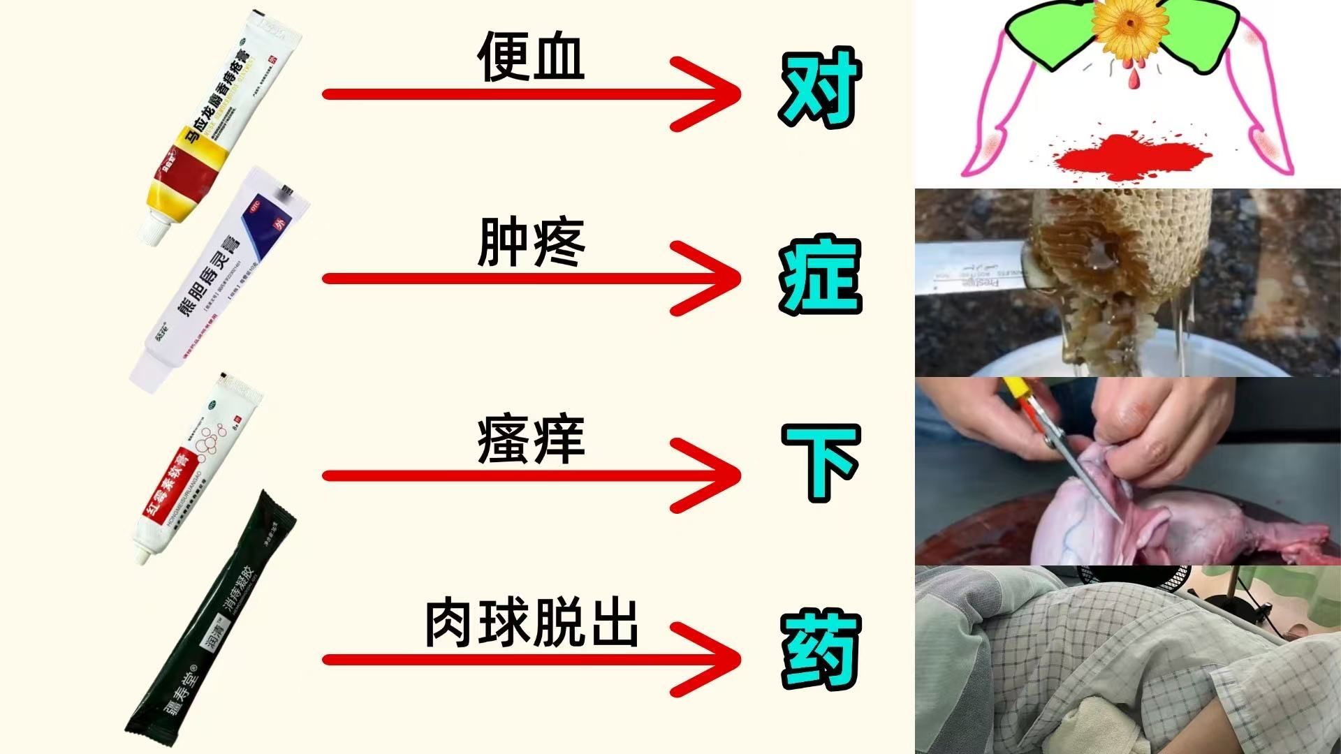 痔疮膏怎么选?过来人总结的超全选购指南!对症下药快速上岸!