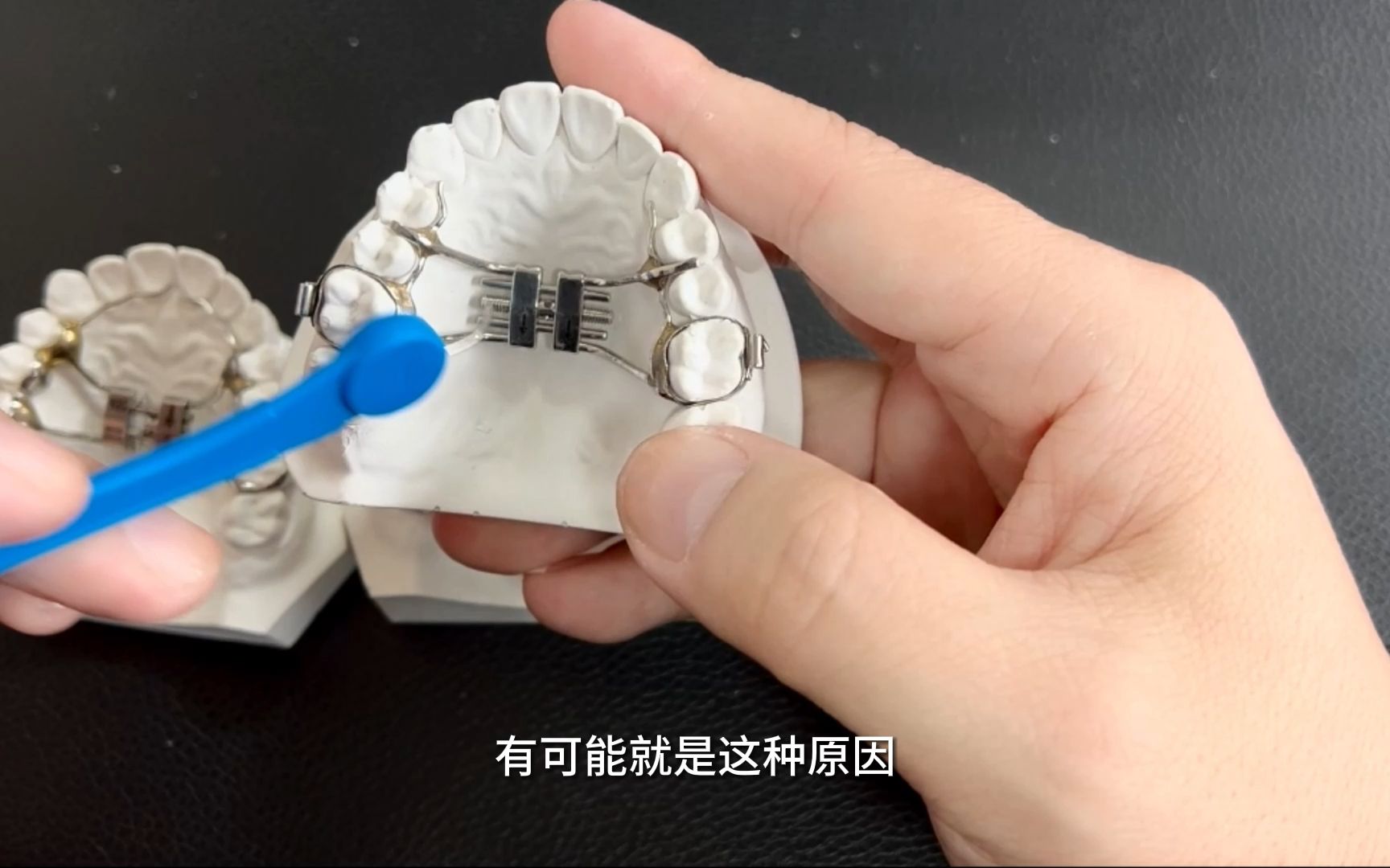 螺旋簧支架式扩弓器有什么区别