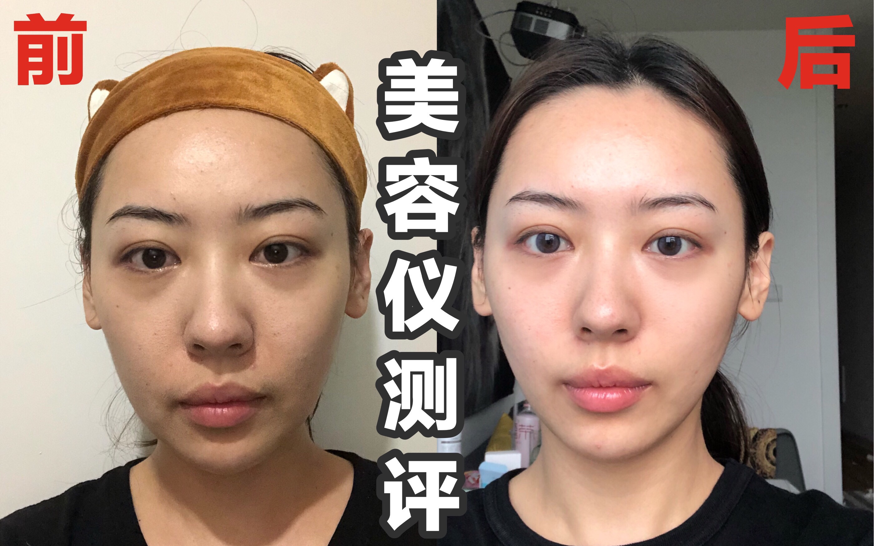 Monini周 | 美容仪测评/提拉面部/facepump到底好不好用