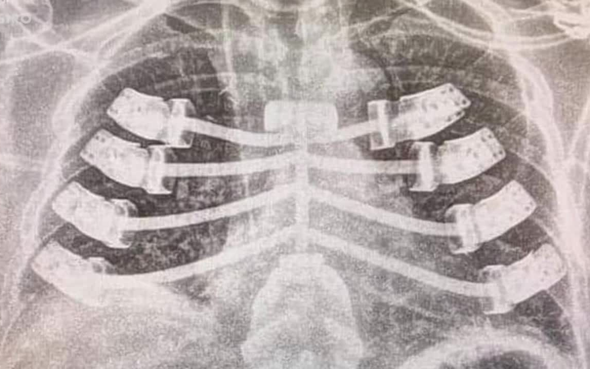 【3D打印】3D打印人类身体零件?3D打印在医疗领域的应用