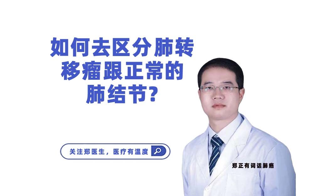 如何去区分肺转移瘤跟正常的肺结节?
