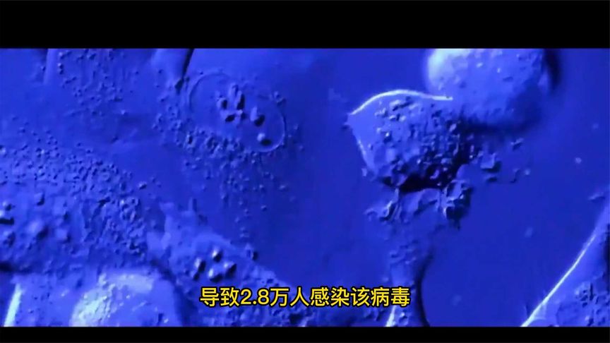 你知道全球最厉害的十大病毒有哪些吗