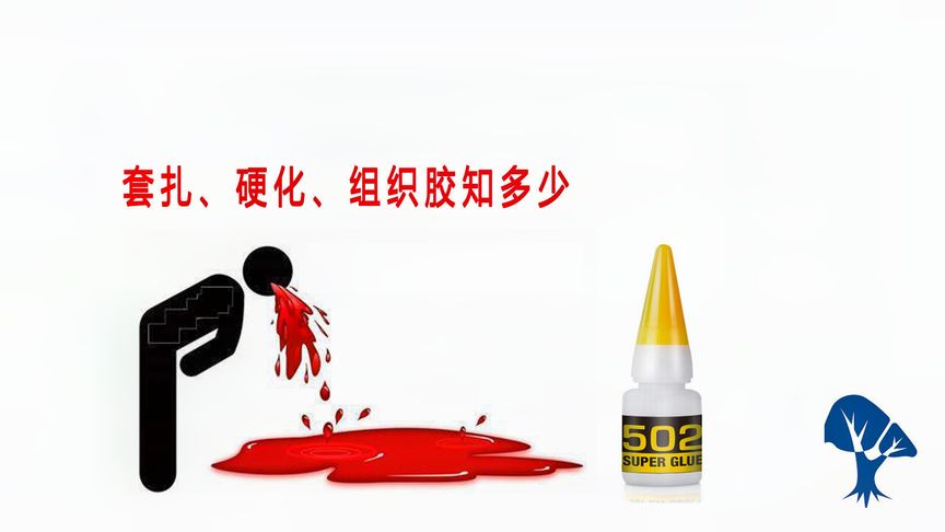 预防肝硬化食管胃静脉曲张再出血:套扎,硬化,组织胶,是什么?