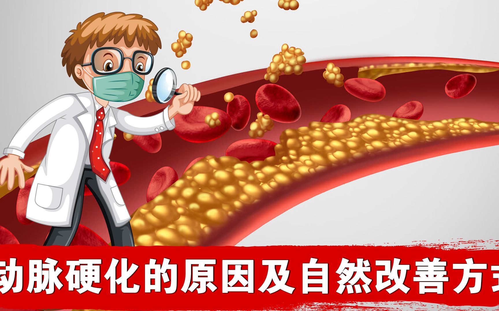 动脉硬化的原因是什么?