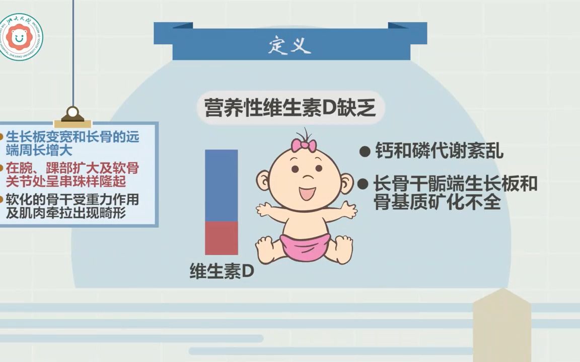 [3.1] 维生素D缺乏性佝偻病病因、发病机制、临床表现