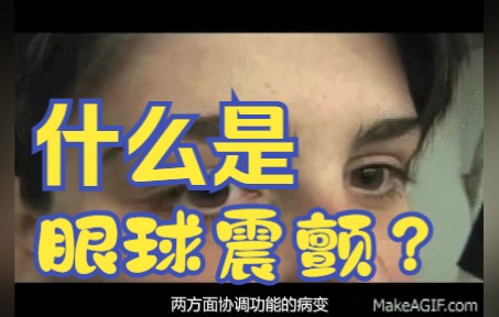 什么是眼球震颤