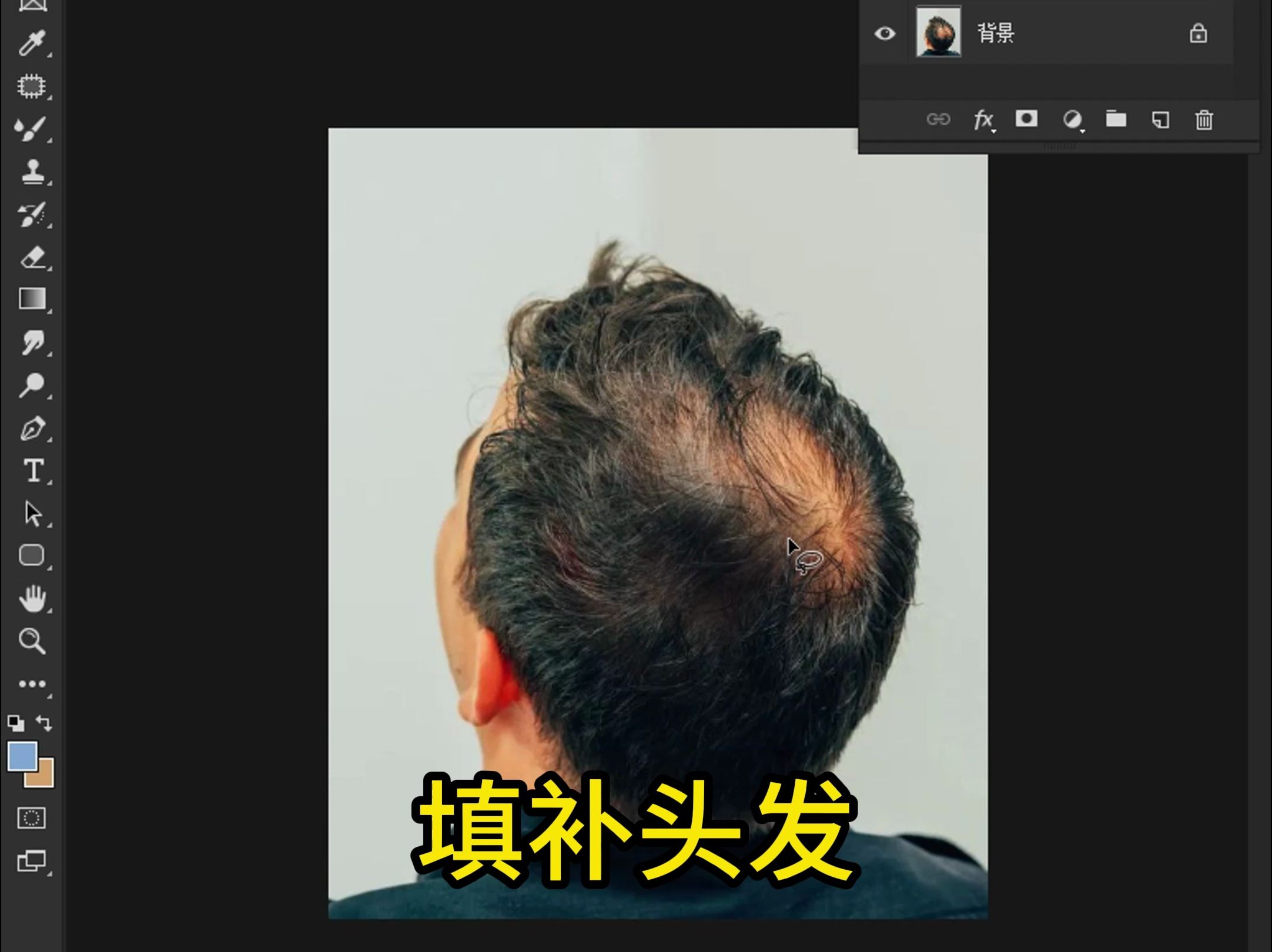 用PS如何修饰脱发