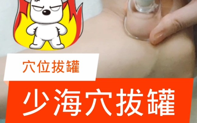少海穴拔罐:有理气通络,益心安神,降浊升清的作用,对表里虚实寒热等有...