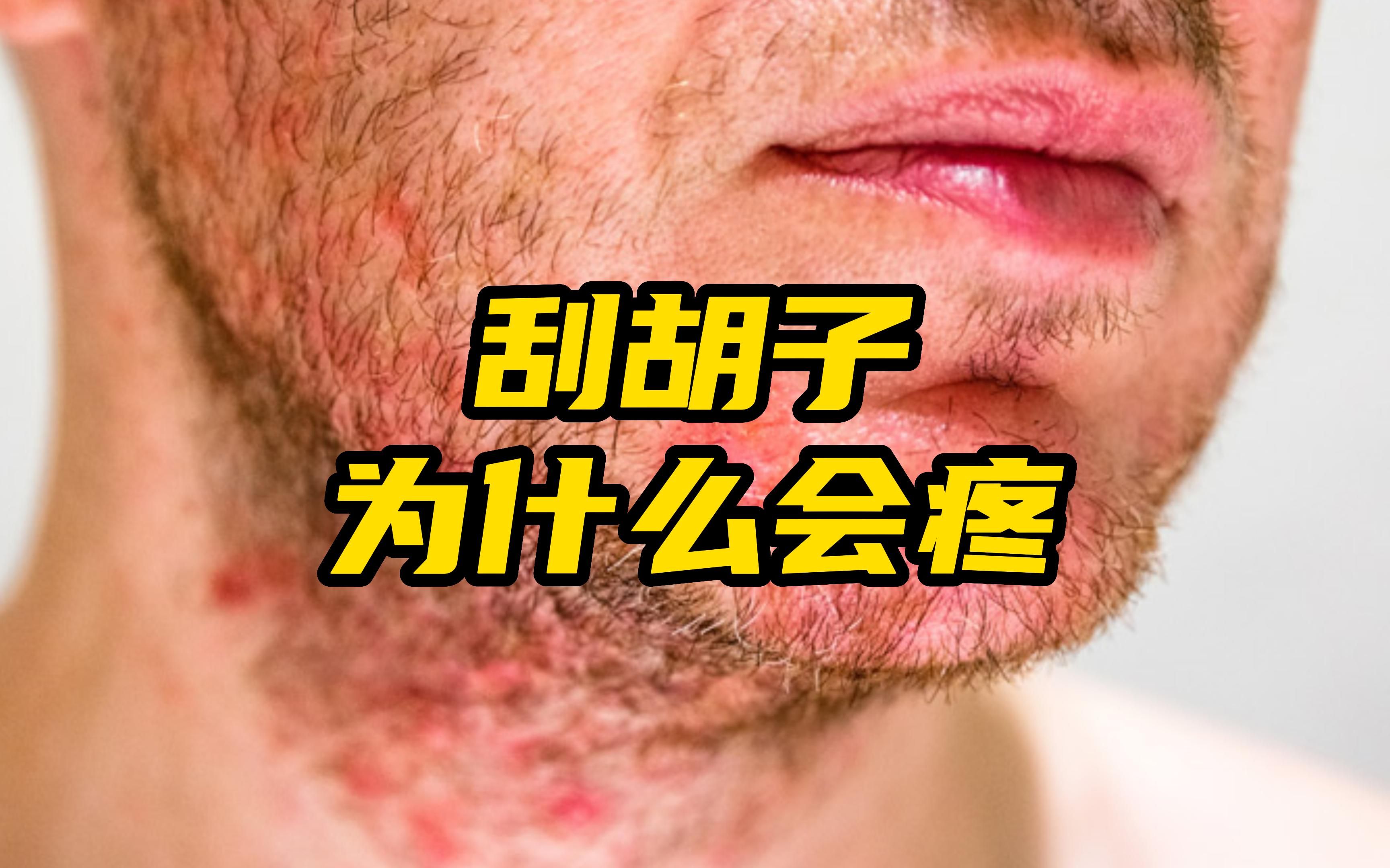 手动一刮胡子就疼?为什么?怎么办?