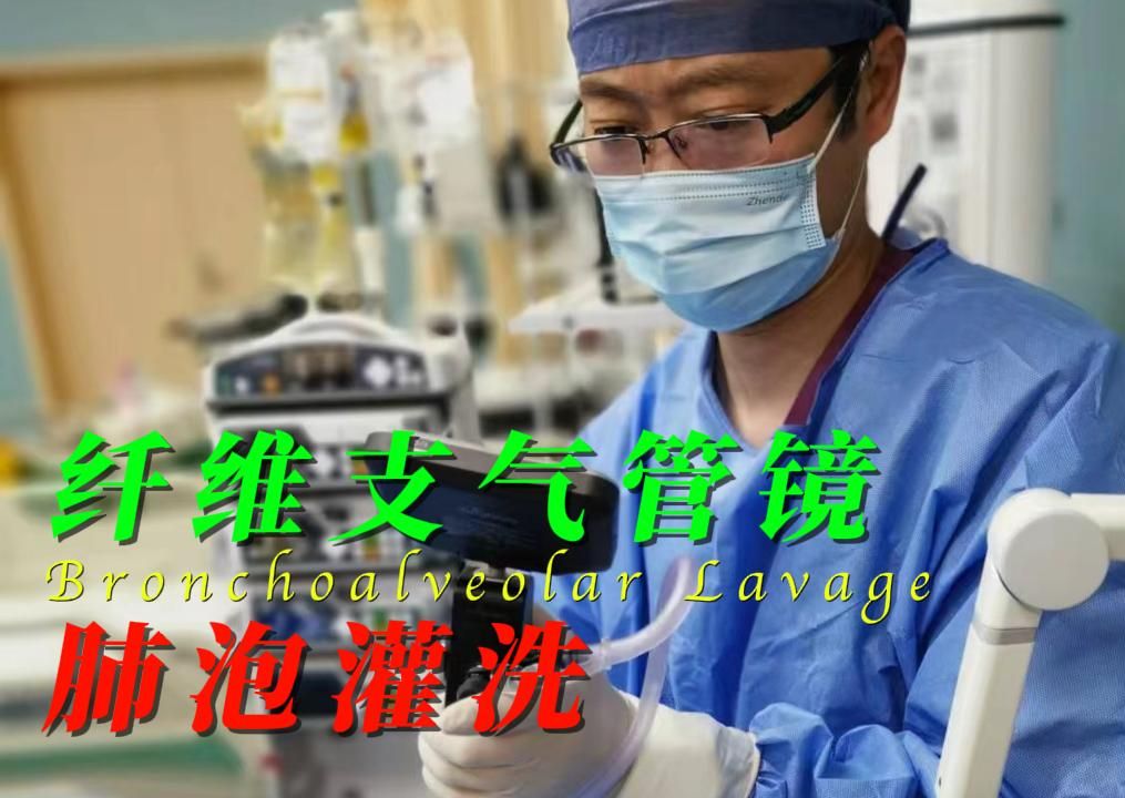 重症医疗技术_纤维支气管镜肺泡灌洗