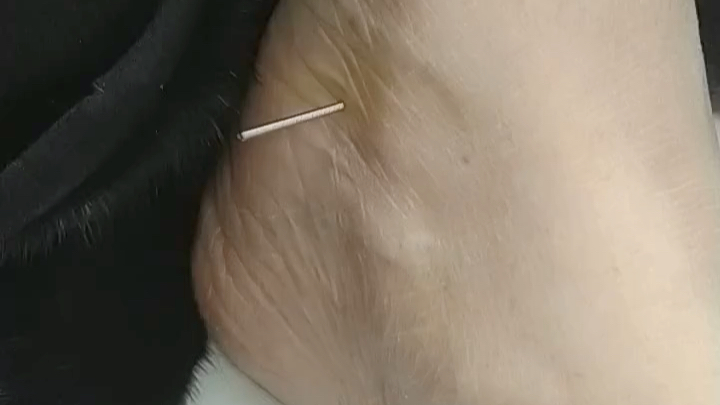 然谷穴的气满自摇。