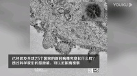 新型冠状病毒的样子