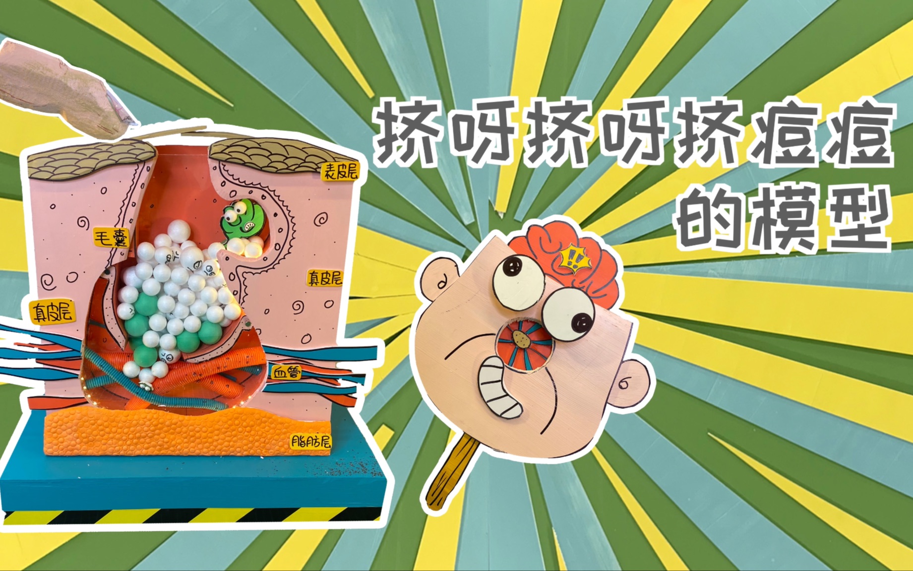 【模型师老原儿】看起来“熟了”的青春痘得赶紧挤掉?千万别!后果...