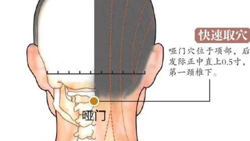 人体要穴之哑门穴