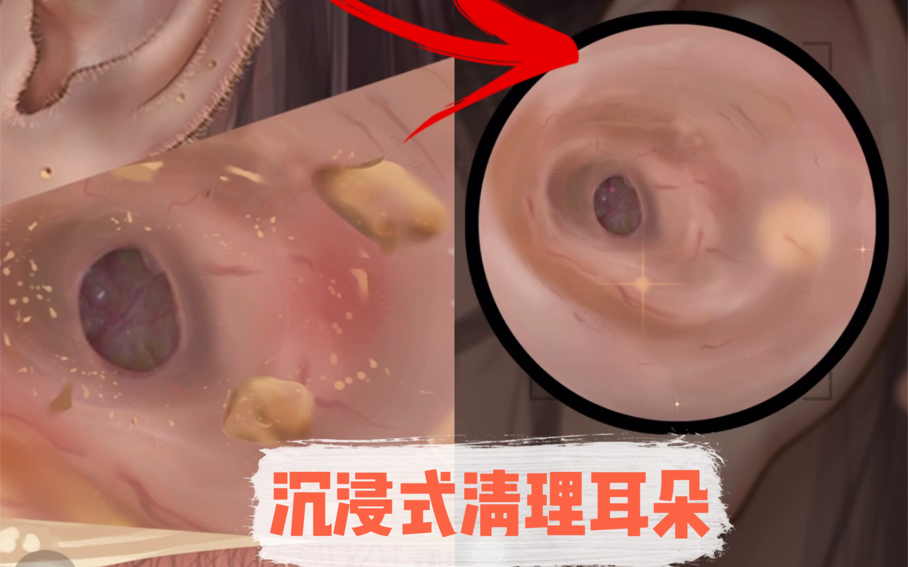 【解压动画】沉浸式清理耳朵