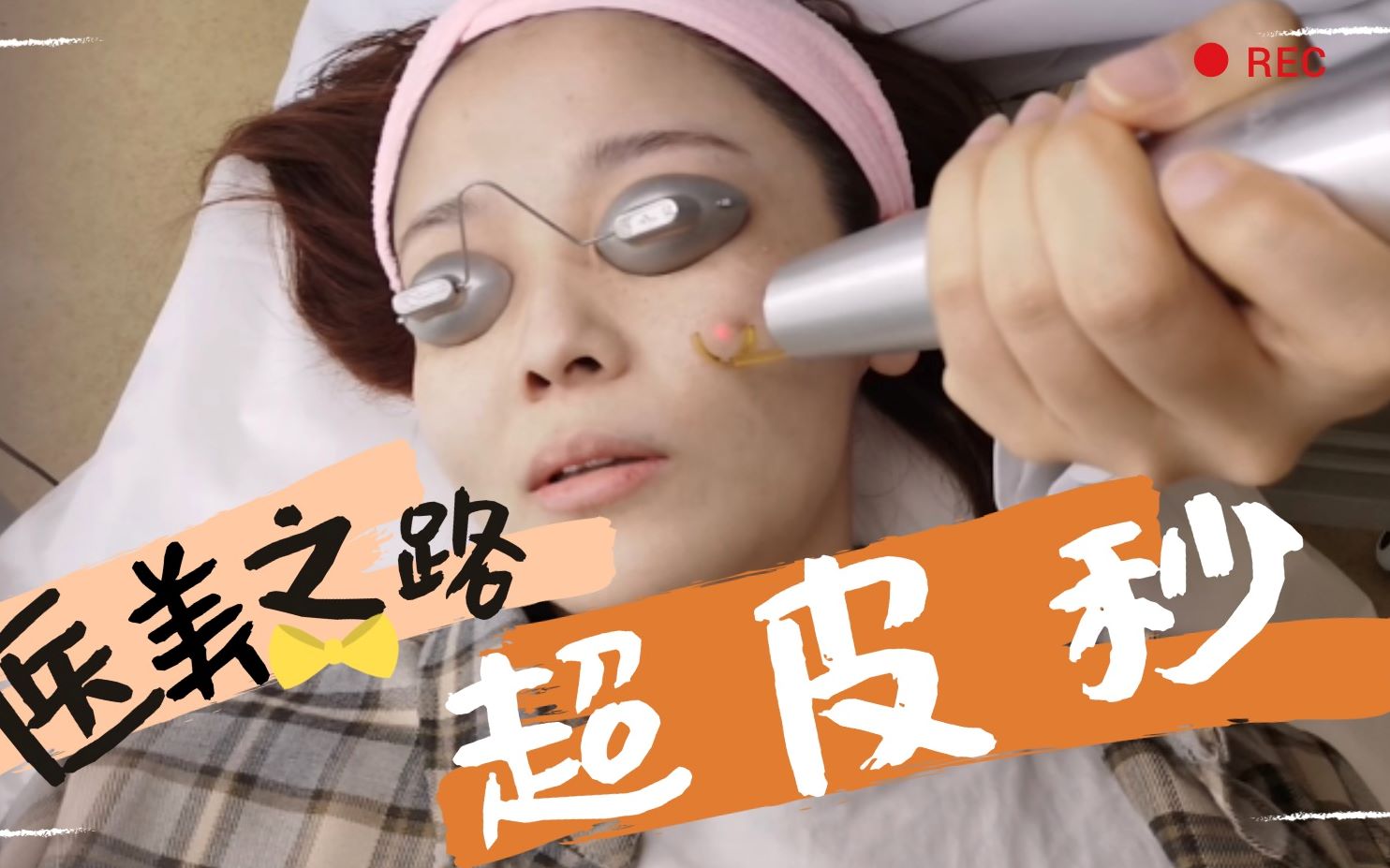 医美之路|实拍超皮秒全过程,密集恐惧症慎点!
