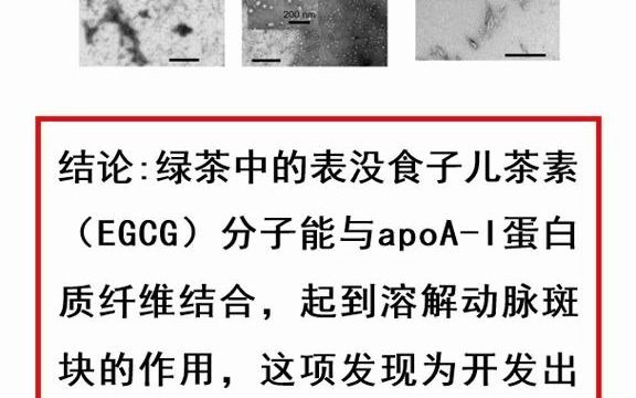 【生物医学实验室日常】一起学习中药治疗冠心病相关科研设计:IF4.01...