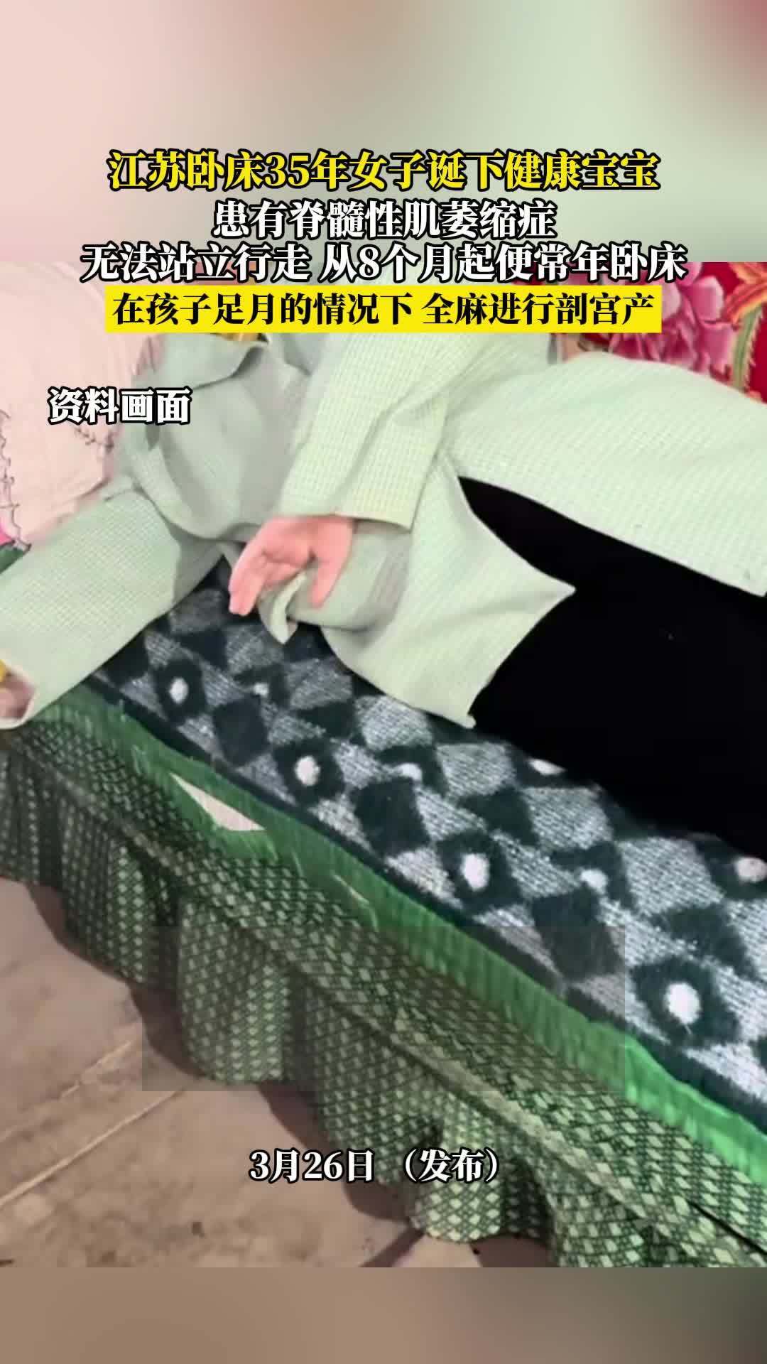 江苏卧床35年女子诞下健康宝宝,患有脊髓性肌萎缩症