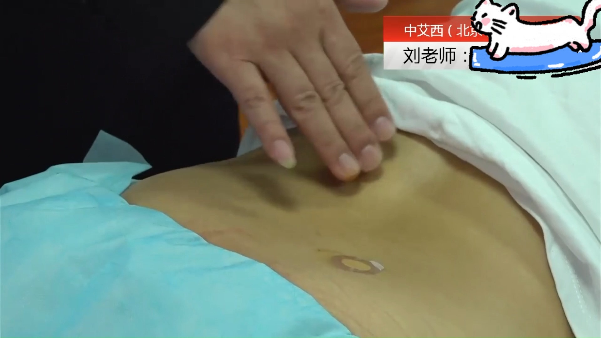 穴位埋线,现场教学中~