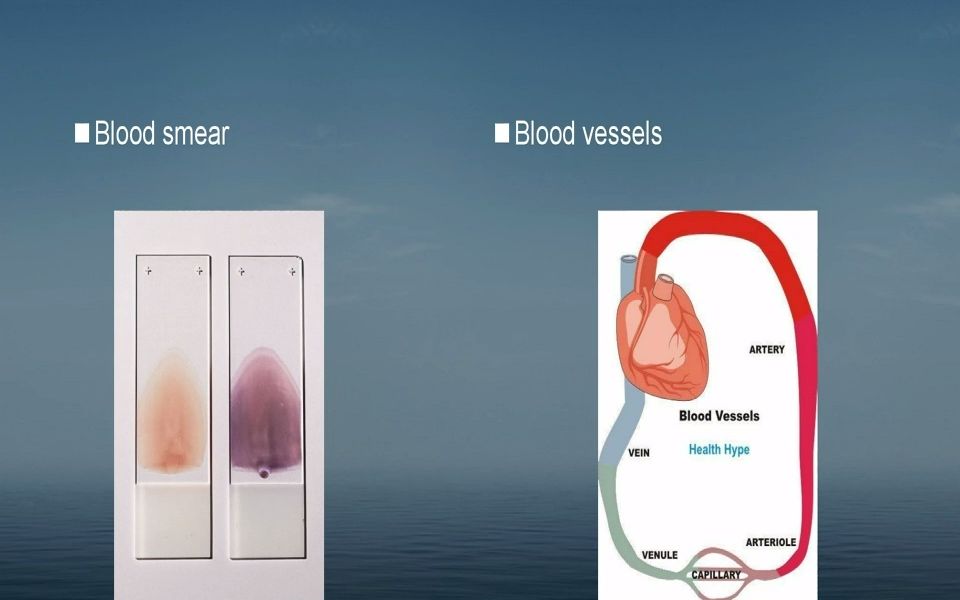 专业医学英语术语单词笔记本——今天讲B