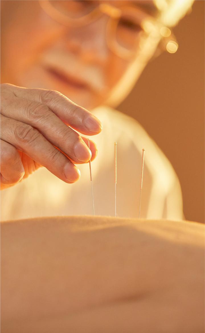 针灸有什么好处和坏处?