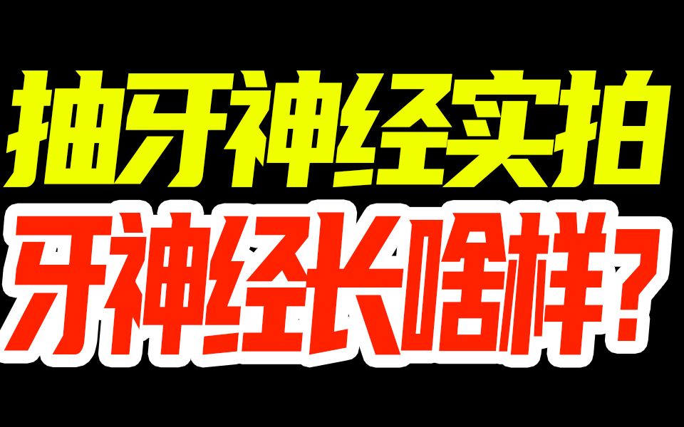 【实拍案例】不血腥!根管治疗实拍,你的牙神经长什么样?