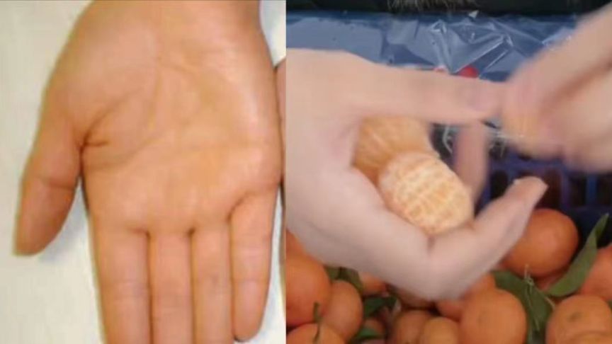 砂糖橘吃多了皮肤真的会变黄,医生:一次性吃一两个