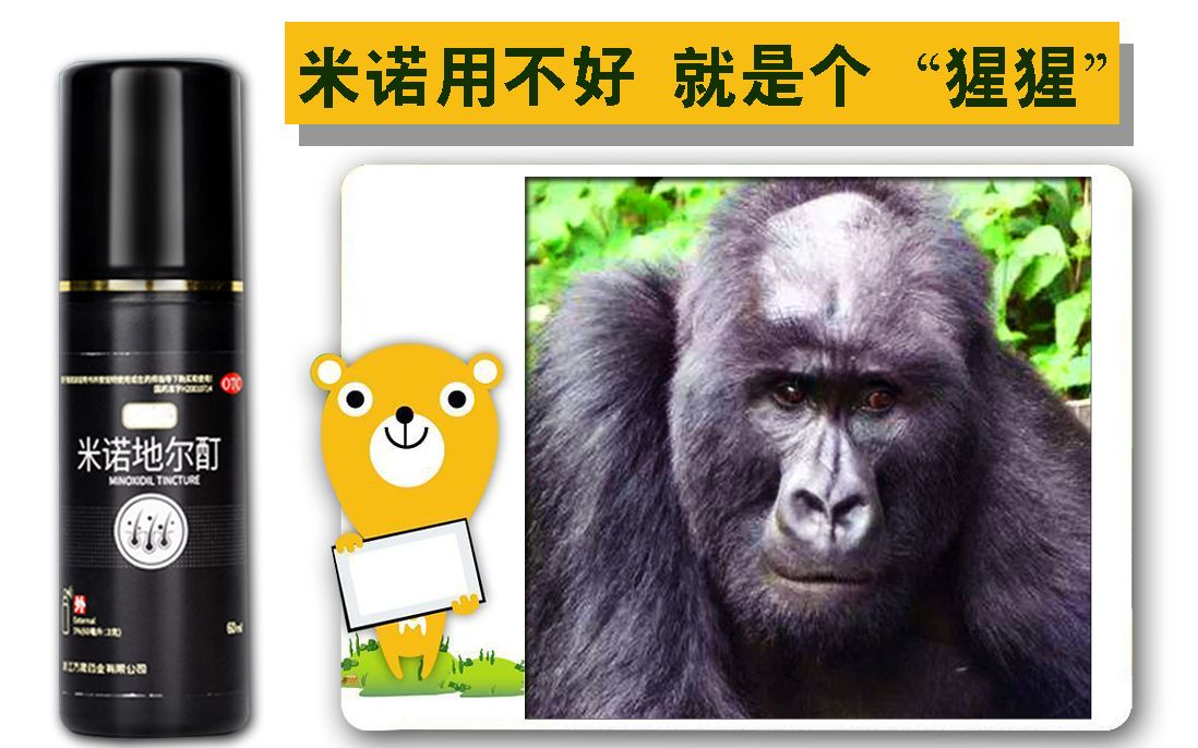 米诺地尔酊生发操作指南,用 不好可能是个猩猩,经供参考