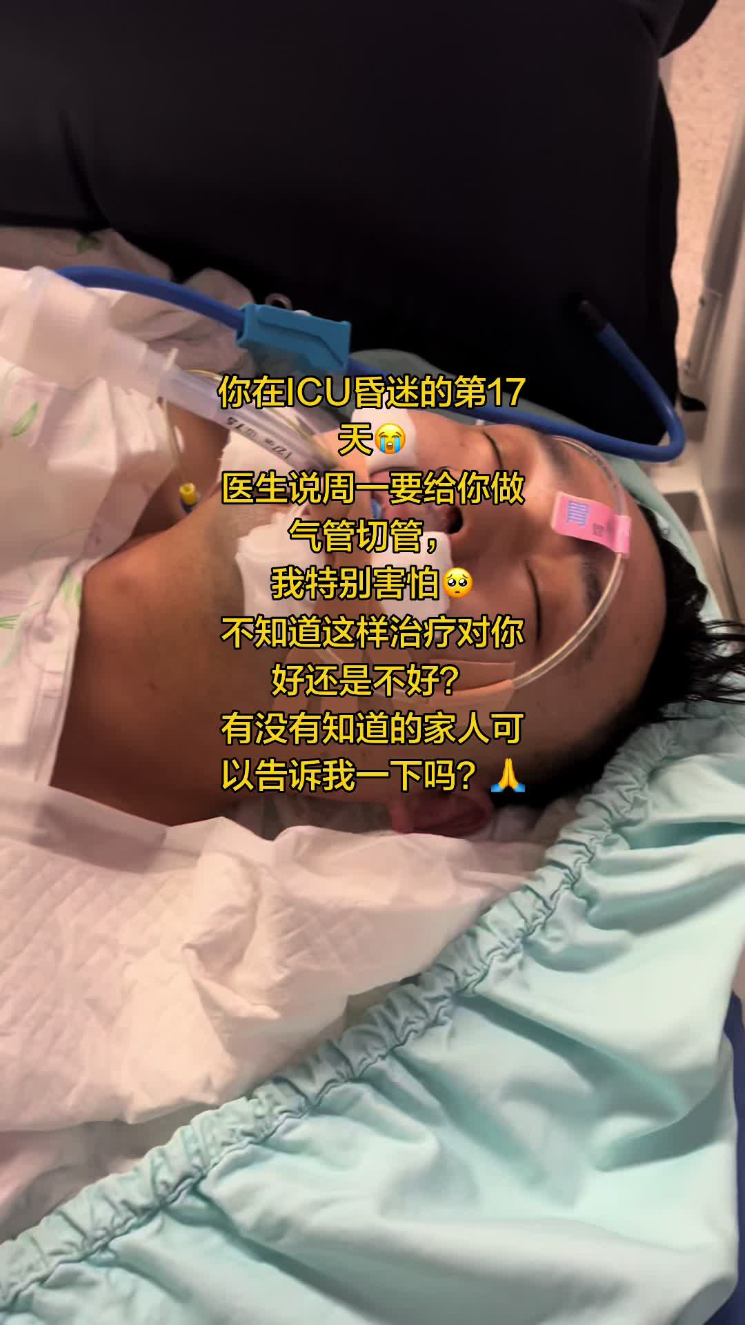 你在ICU昏迷的第17天ߘ� 医生说周一要给你做气管切管, 我内心特别...