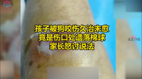孩子被狗咬伤久治未愈,竟是伤口处遗落棉球,家长怒讨说法