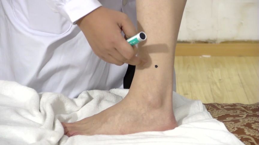 每日一穴位——悬钟穴(坐骨神经痛,按此穴)