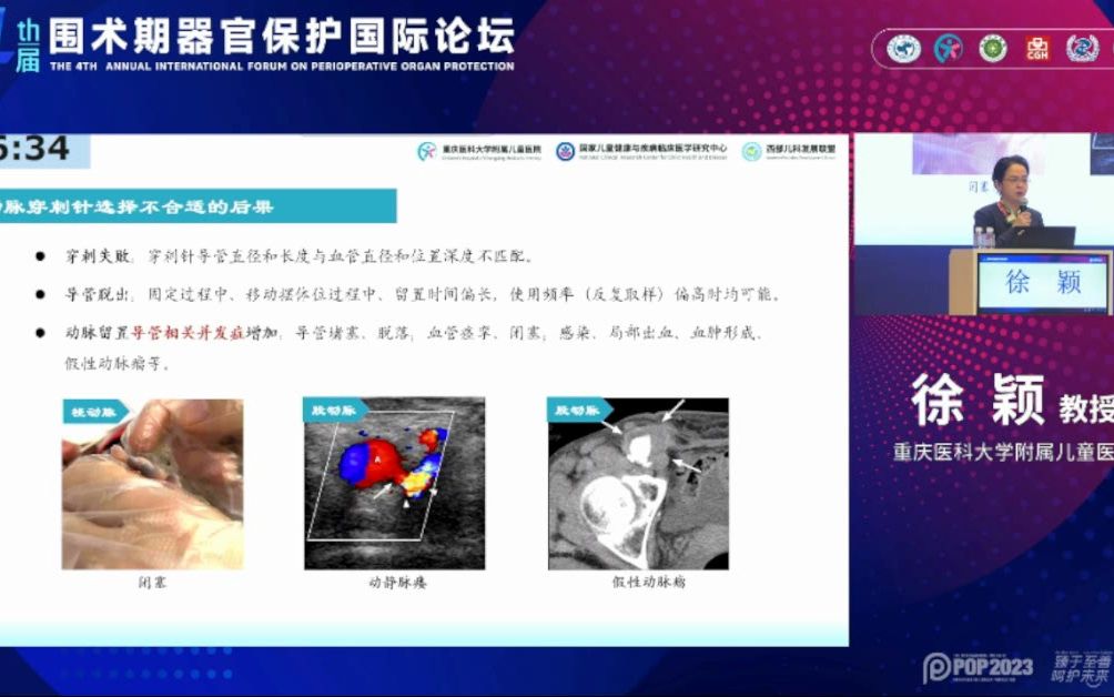 超声引导下儿童血管穿刺置管热点问题解析--徐颖教授