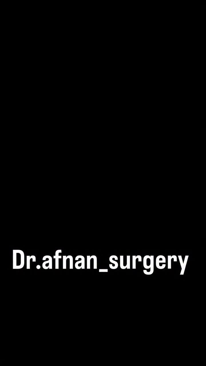 作者:dr.afnan_surgery 滞留前磨牙牙根的微创拔除术 操作流程: 首先...