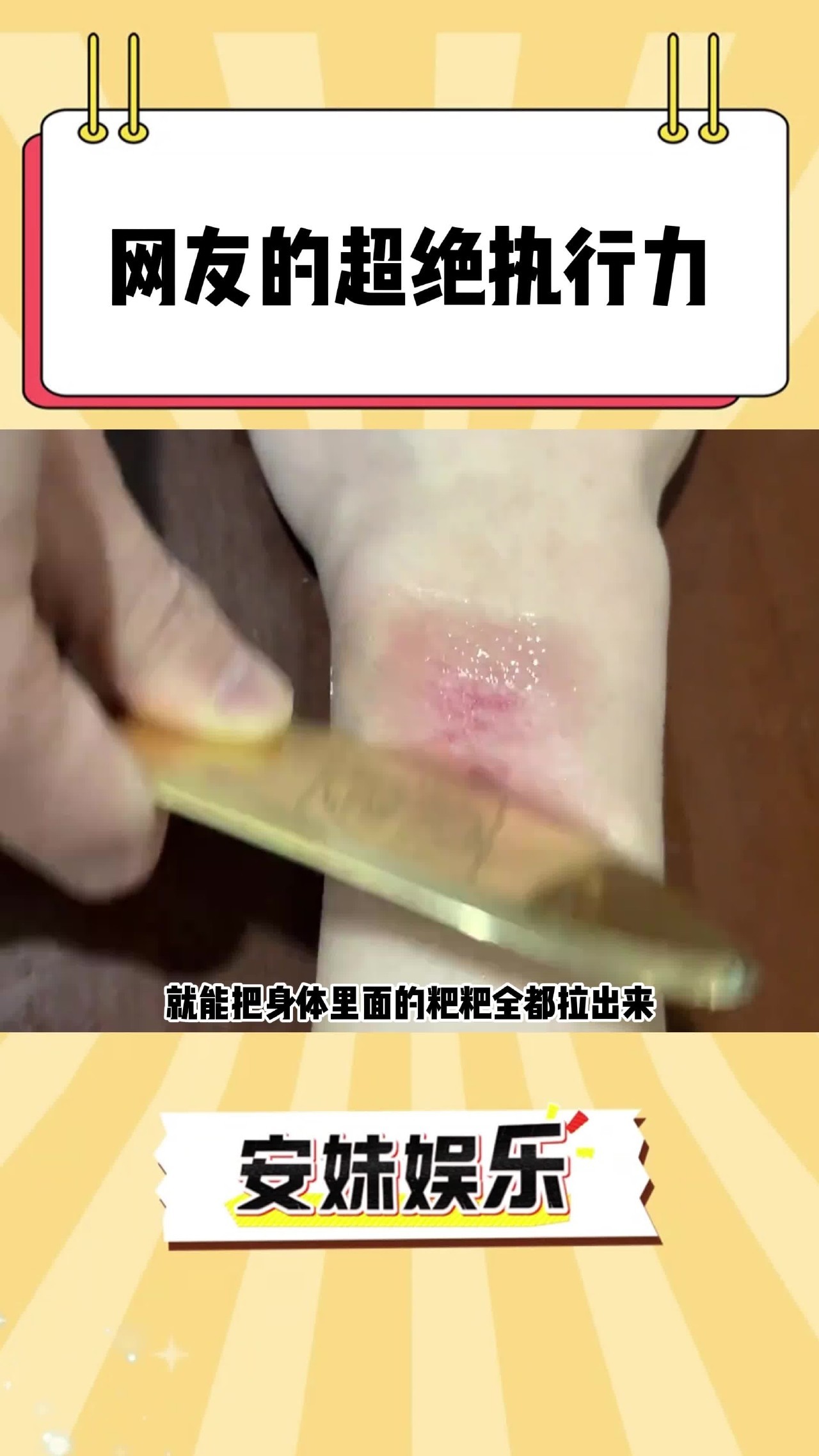 揉开支沟穴,就能把身体里面的粑粑全都拉出来