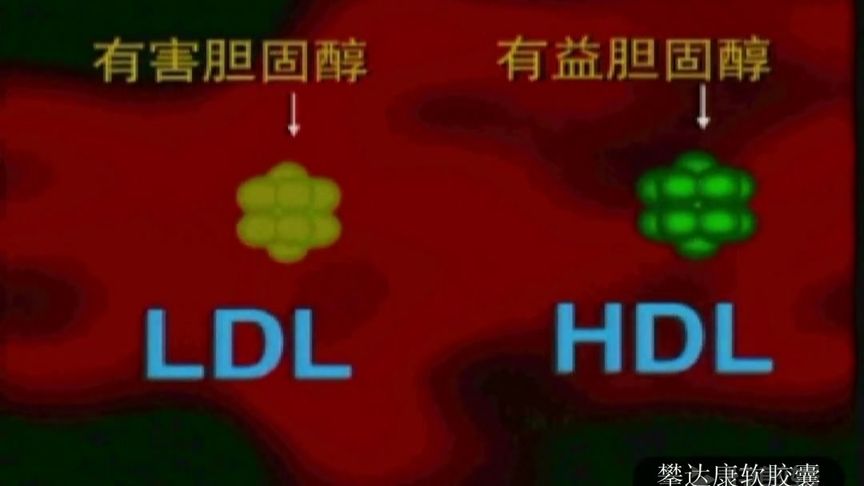 “好胆固醇”HDL清除“坏胆固醇”LDL,畅通血管!