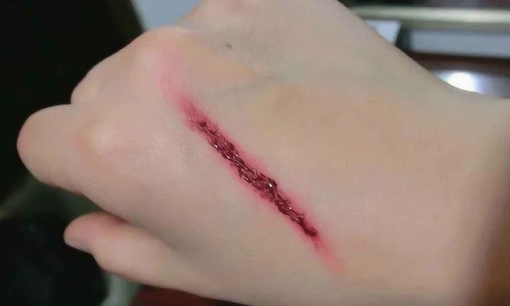 皮肤受伤是怎样愈合的?3D动画模拟全过程,画面令人震撼!