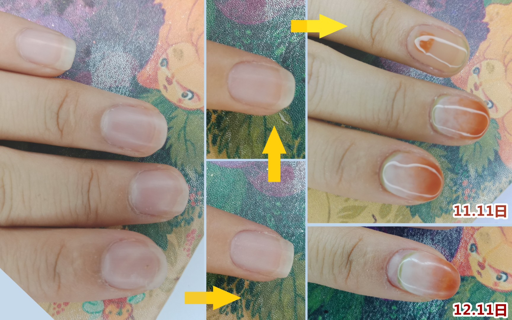 美甲前置处理(去死皮+修甲型+打磨甲面) - 对新手超友好省力的陶瓷...