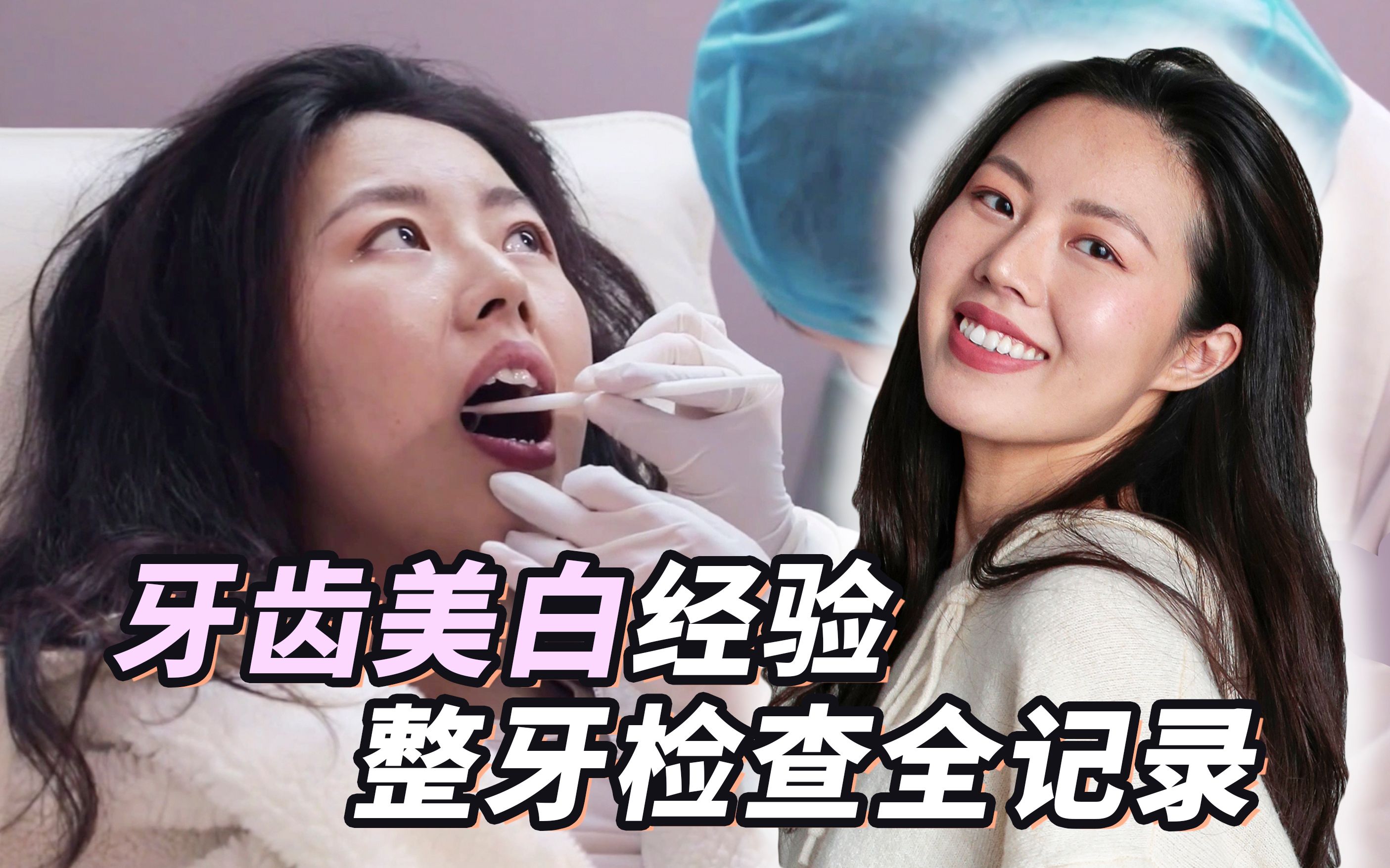 「被问无数遍」牙齿美白经验分享,正畸检查全记录!我应该整牙吗!?